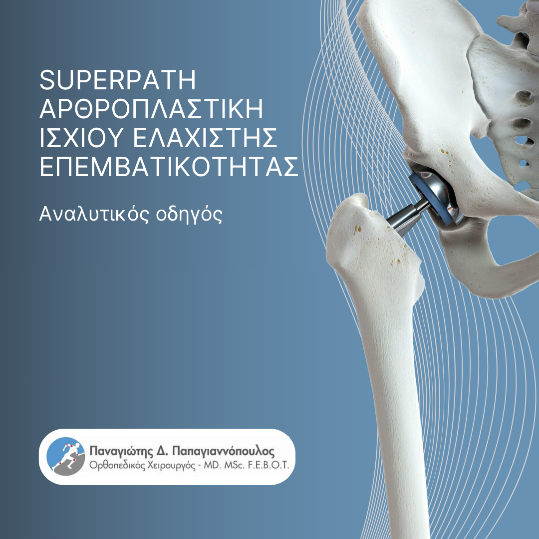 SuperPath Αρθροπλαστική ισχίου ελάχιστης επεμβατικότητας