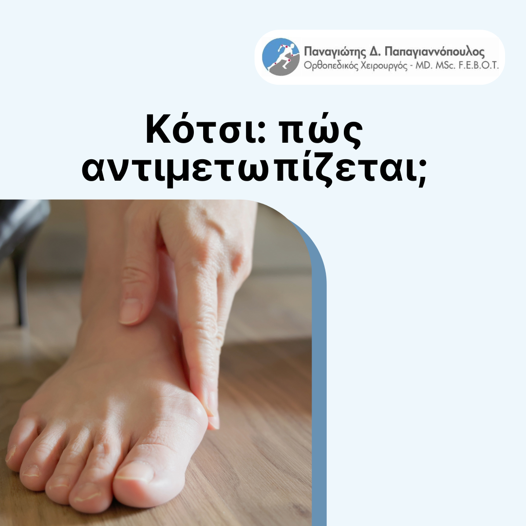 Κότσι: πώς αντιμετωπίζεται;