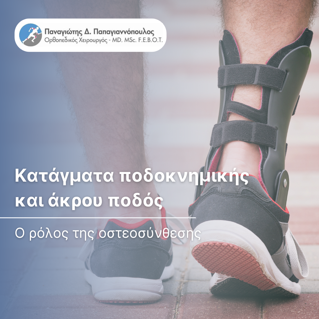 Κατάγματα ποδοκνημικής και άκρου ποδός και οστεοσύνθεση