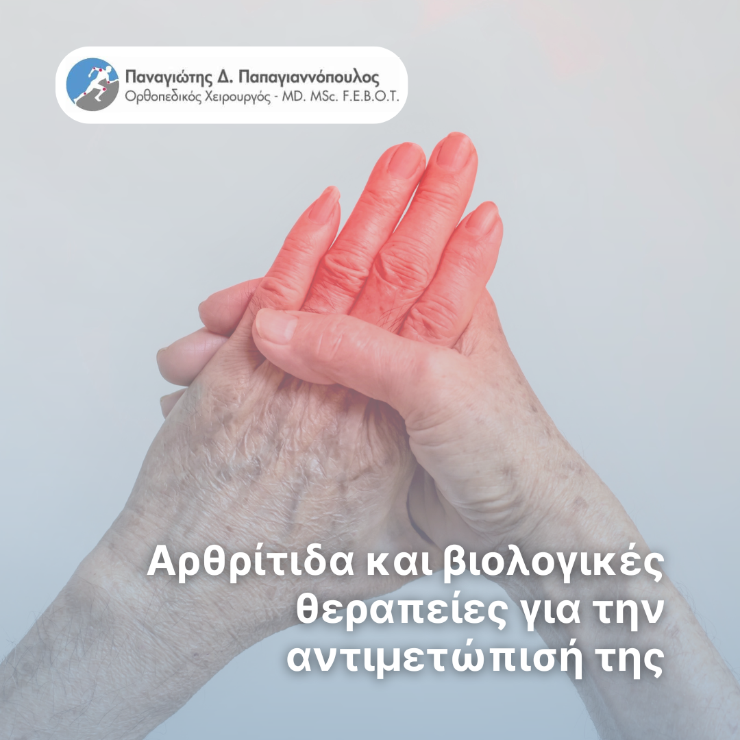 Αρθρίτιδα και Βιολογικές θεραπείες για την αντιμετώπισή της