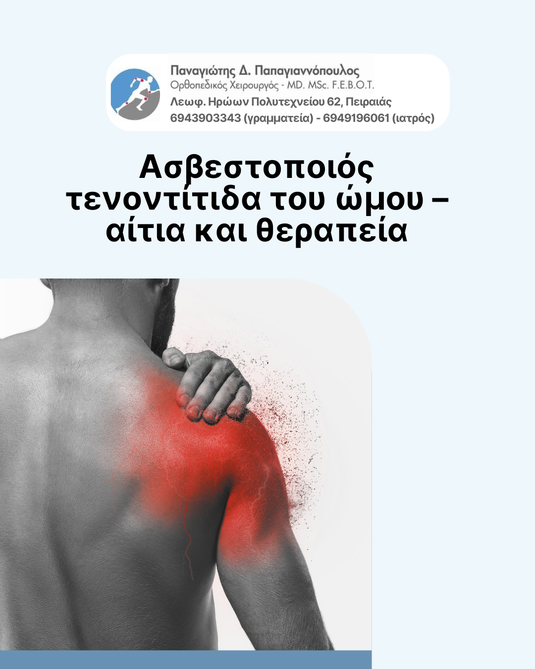 Ασβεστοποιός τενοντίτιδα: Αίτια, Συμπτώματα και Θεραπεία